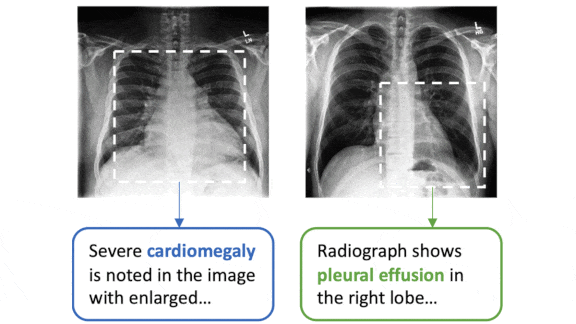 A Deep Learning Method for Medical X-rays with Text